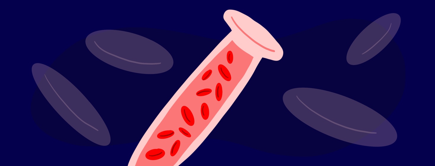 Antiphospholipid Antibody Syndrome | Lupus.net