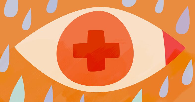 How My Lupus Caused an Eye Condition Called Scleritis