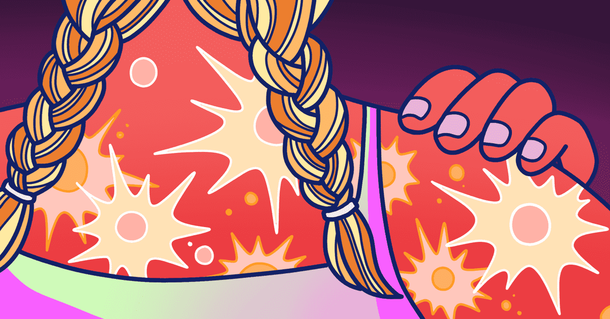 Navigating Different Types of Lupus Skin Flares