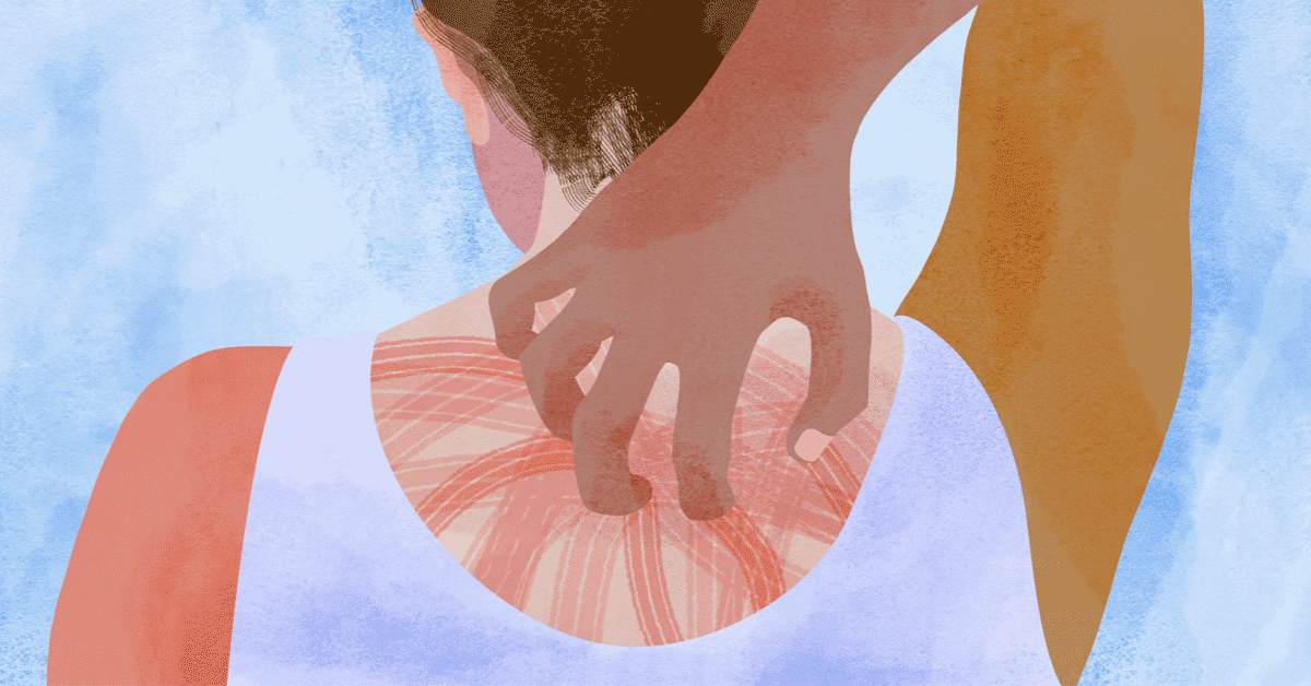 Itchiness With Lupus: Scratching the Surface | Lupus.net